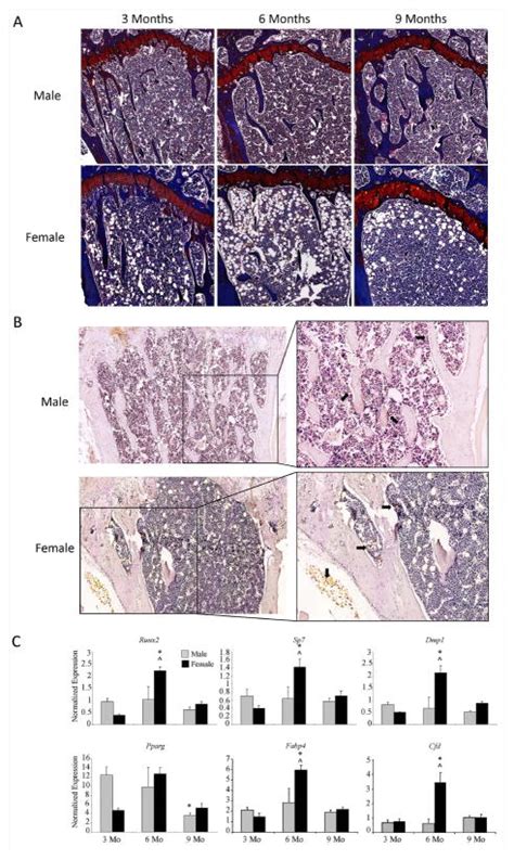 Intrinsic Sex Linked Variations In Osteogenic And Adipogenic
