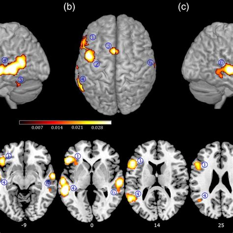 Significant Clusters Associated With Sentence Comprehension Both Download Scientific Diagram