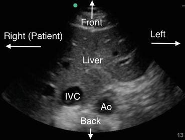 Abdominal Ultrasound And Genitourinary Ultrasound In The Intensive Care