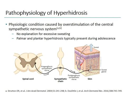 Hyperhidrosis Is Burdensome Ppt Download