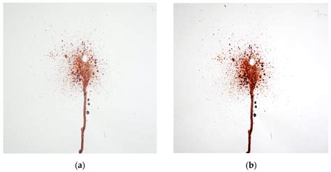 Defining Patterns And Behaviours Of Forward Spatter Gunshot Misting