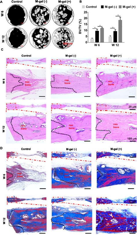 Neobone Formation Of Composite Constructs In The Rat Calvarial Defects