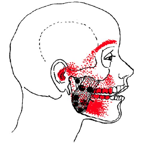 Masseter Oefeningen En Behandeling Fysiotherapie4all
