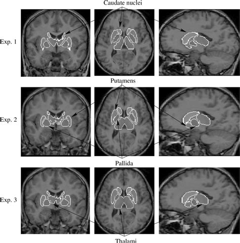 Segmentation Of The Grey Nuclei Top Row Without Shape Analysis
