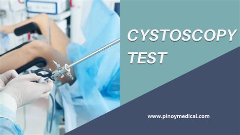 Cystoscopy Test Price In The Philippines 2026 — Pinoymedical