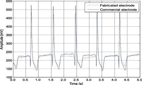 Ecg Comparison Results Between The Printed Active Electrode And