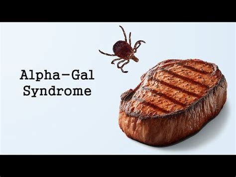 Understanding Alpha Gal Syndrome Causes And Symptoms Explained