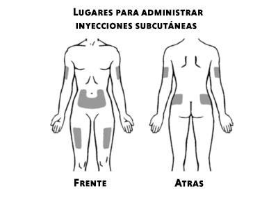 Uso De La Vía Subcutánea En Cuidados Paliativos