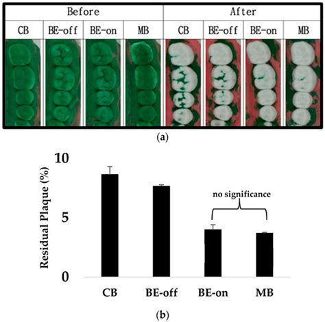 Bioengineering Special Issue Application Of Bioengineering To Implant Dentistry