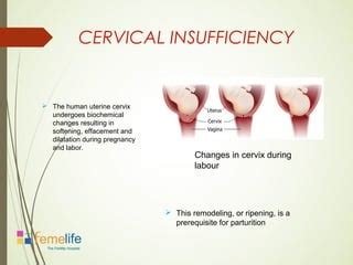Cervical Insufficiency Ppt