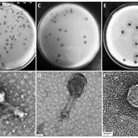 Figure Legends 371 Figure 1 372 Phage Isolation Using Double Layer