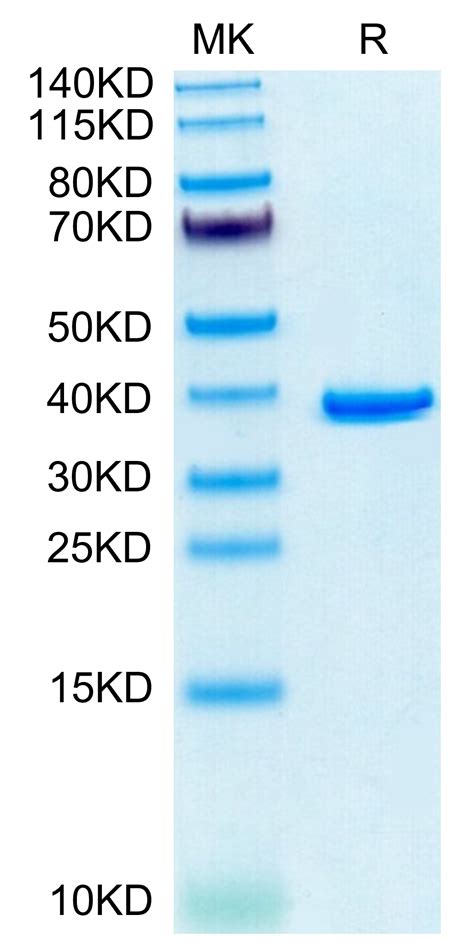 Human Anxa2 Protein Recombinant Reprokine