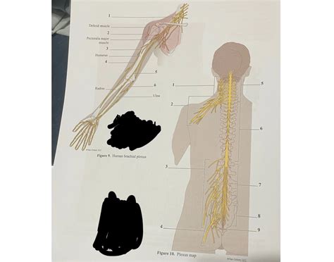 Plexus Map Arm Section Quiz Plexus Map Arm Section Quiz