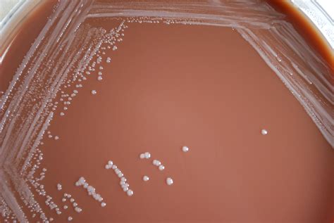 Free Picture Temperature Abortus Bacteria Disease Brucellosis