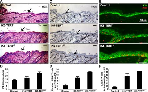 Both Tert And Tertci Enhance Proliferation Of Interfollicular Epidermis