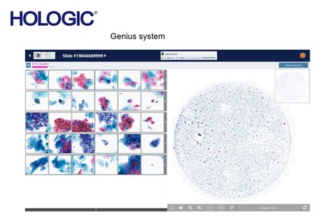 Current Dilemmas And Future Solutions In Cervical Screening Bac