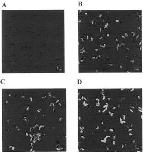 Figure 1 From The Detection Of Bovine Lactoferrin Binding Protein On Toxoplasma Gondii