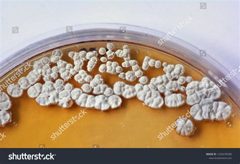 Actinomyces Colony Morphology