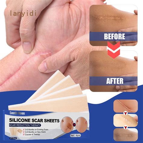 Efficient Surgery Scar Removal Silicone Gel Sheet Therapy Patch For