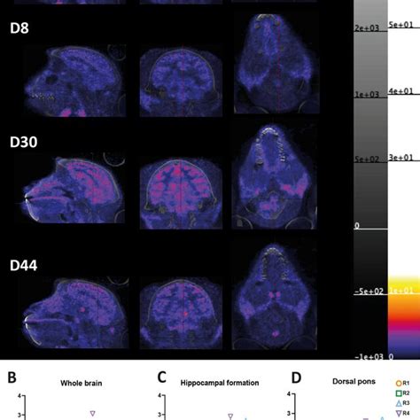 Increased Tspo Expression In The Hippocampus And Pons Correlates With