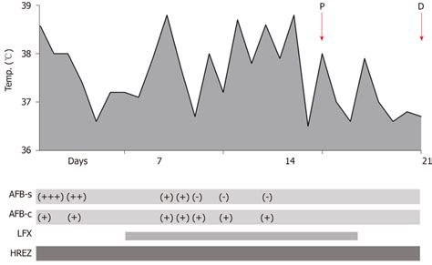 The Patients Fever Pattern Sputum Acid Fast Bacilli Results And Download Scientific Diagram