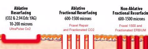 Skin Aesthetics Laser Therapy Skin And Hair Academy