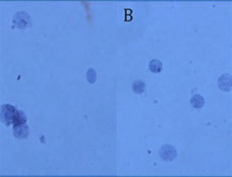 Influence Of RNA Extraction Methods And Library Selection Schemes On RNA Seq Data RNA Seq Blog