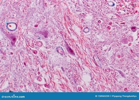 Nerve Human Under The Microscope Royalty Free Stock Image 158565232