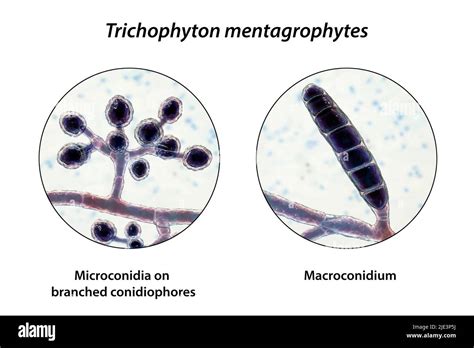 Microconidia