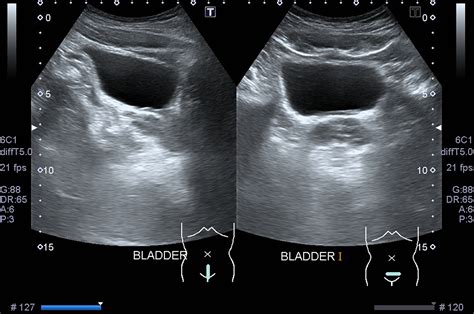 St Andrews Clinics Diagnostic Ultrasound Urogenital Ultrasounds