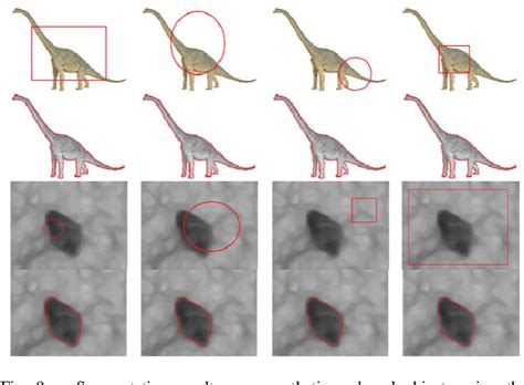 Figure 9 From Edge Based Local And Global Energy Active Contour Model Driven By Signed Pressure