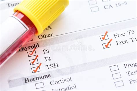 Thyroid Hormone Test Stock Image Image Of Scientific