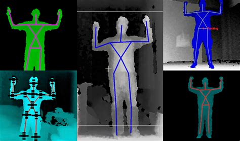 Our Parkinsons Place Novel Kinect System Helps Keep Parkinsons Patients Moving