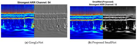 Deep-Learning-Based Arrhythmia Detection Using ECG Signals: A Comparative Study and Performance ...