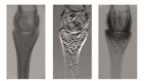 Novel Tri Contrast Imaging And In Situ Optimization With The Prismaxrm 3d X Ray Microscope