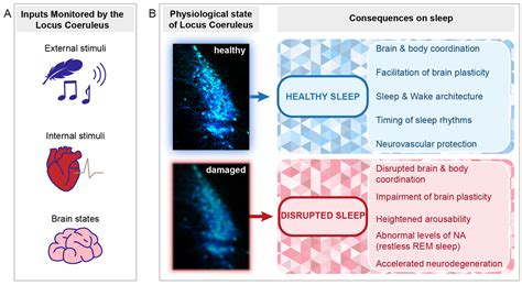 When The Locus Coeruleus Speaks Up In Sleep Recent Insights Emerging
