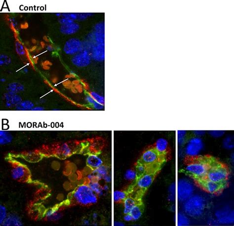 Targeting Endosialincd248 Through Antibody Mediated Internalization