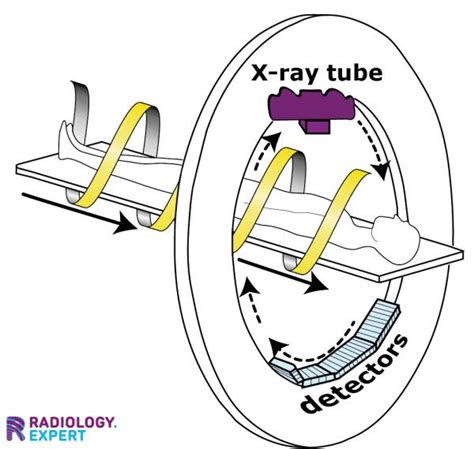 X Ray Ct Technique