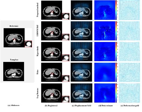 Figure 10 From A Bi Variant Variational Model For Diffeomorphic Image Registration With Relaxed
