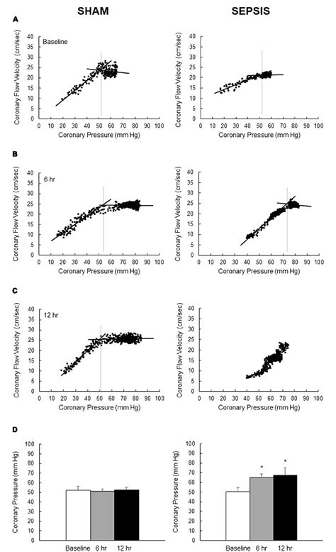 Figure 1 From Early Hyperdynamic Sepsis Alters Coronary Blood Flow