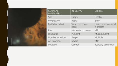 Peripheral Corneal Diseases Pptx