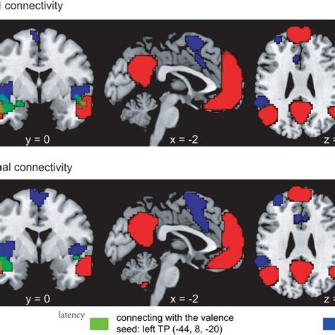 Resting‐state Functional Connectivity Maps Of The Atl Subregions For Download Scientific