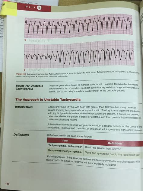 ACLS CHAPTER ACLS CASES MAIN CHAPTER OF ACLS ACLS CHAPTER ACLS CASES MAIN CHAPTER OF ACLS