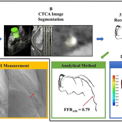 The Sequential Steps Involved In The Calculation Of Non Invasive Download Scientific Diagram