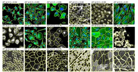 Iss空间转录组的细胞分割算法汇总 Stardist、cellpose、qupath、scs 腾讯云开发者社区 腾讯云