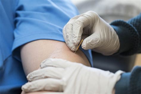 Trigger Point Dry Needling Advantage Rehab And Physical Therapy