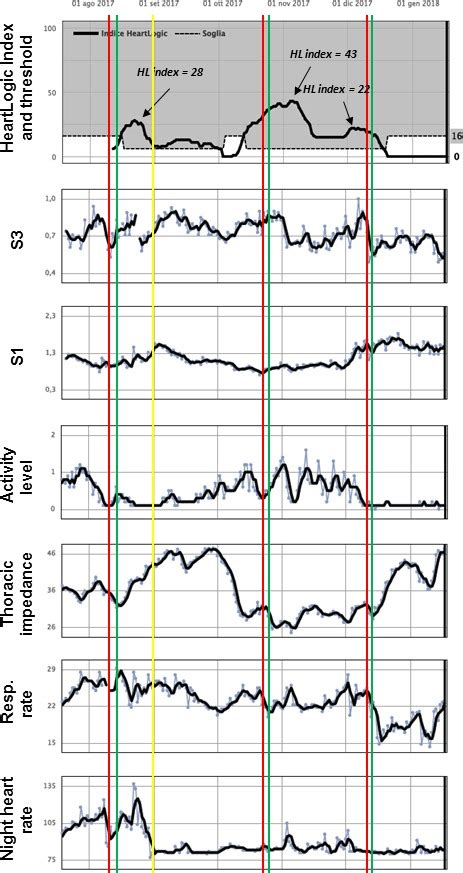 Preliminary Experience With A Novel Multisensor Algorithm For Heart
