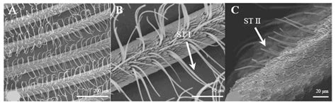 Comparative Morphology And Ultrastructure Of Antennal Sensilla In Dendrolimus Superans