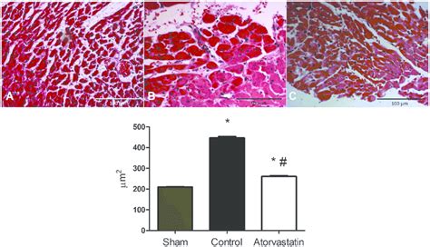 Myocyte Cross Sectional Areas In Remote Regions Of Lv Infarcts Images