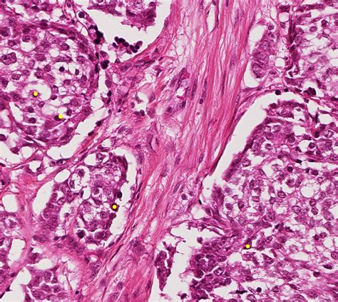 Not Mitosis Detection Object Detection Dataset By Hifza